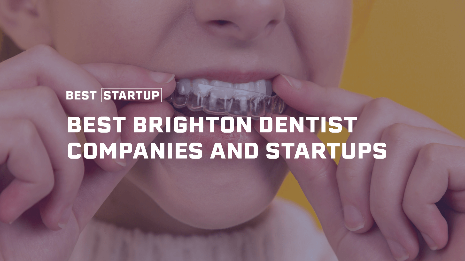 Brighton's Best Bites: A Tour of Dental Excellence - Best Startup US